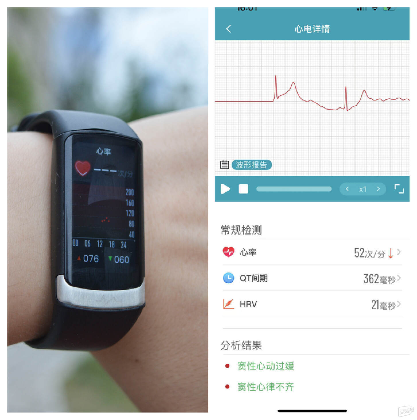 动态监测 健康可视化 Dido F50s Pro大屏血糖血压智能手环体验 聚超值